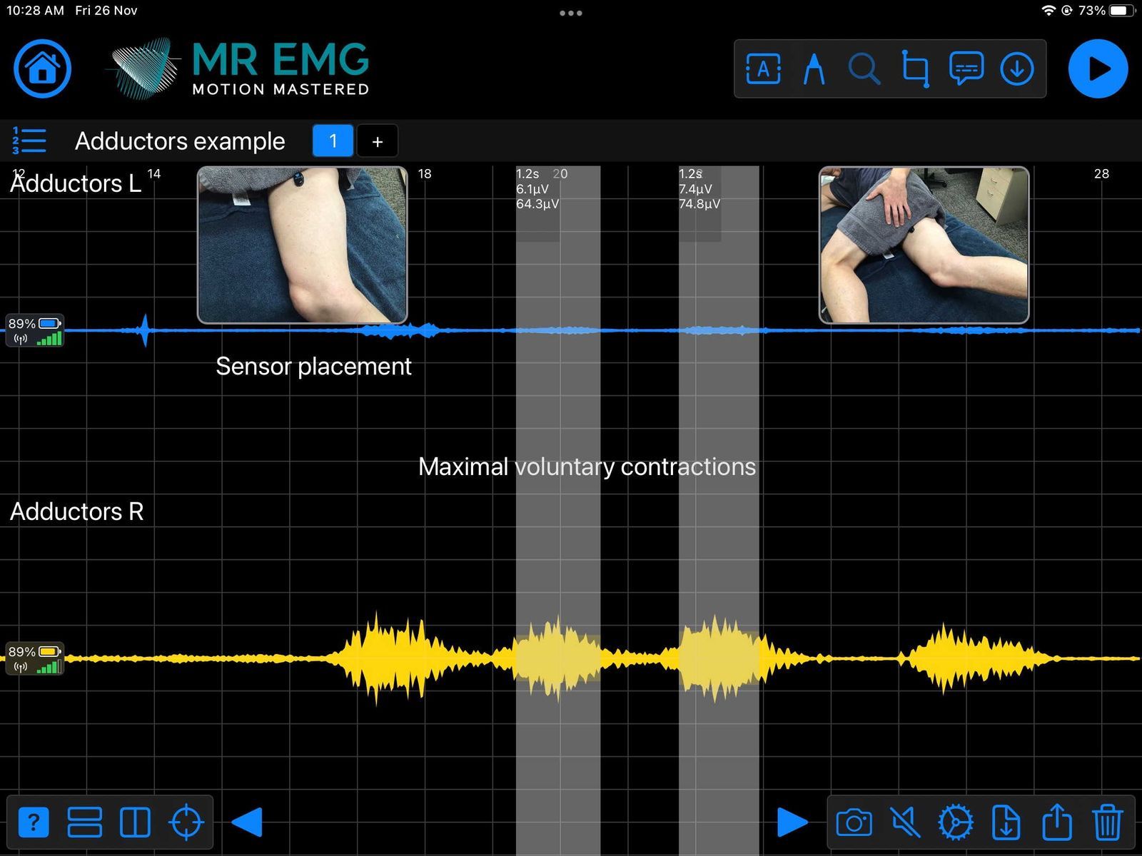 Sensor Positioning Guide